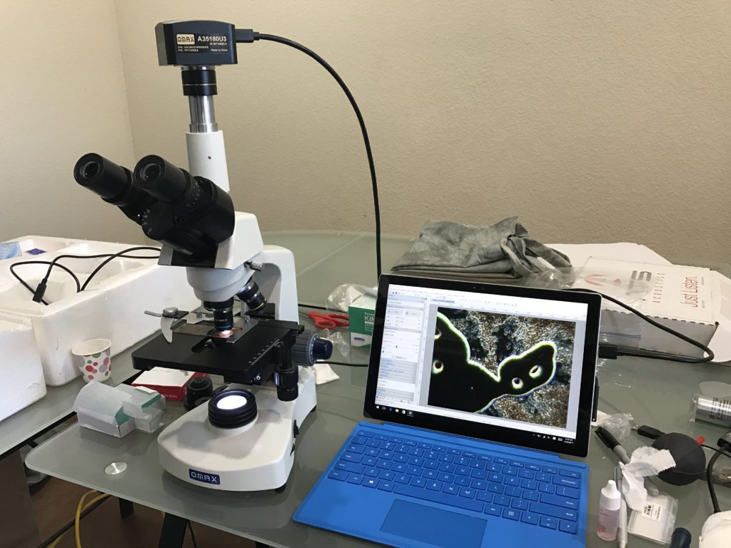 Lyme disease and co-infections – How I Recovered